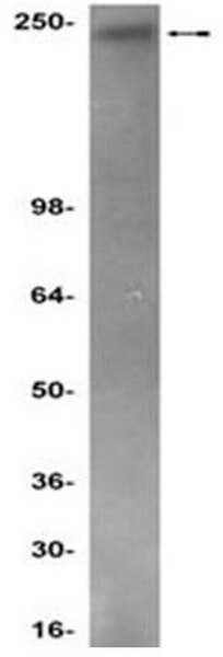 ChIPAb+ RNA Pol II - ChIP Validated Antibody and Primer Set | 17-620
